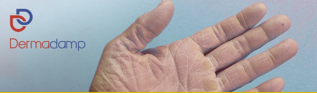 Introducing Dermadamp – Dermadry Philippines